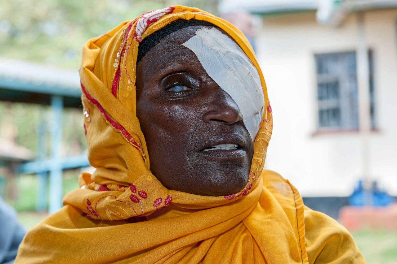 Trachom - GESUNDES AFRIKA